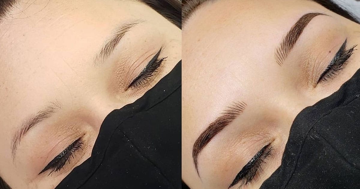 Gallery - LA MicroBrow